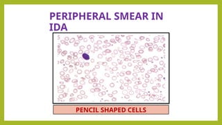 PERFORM, IDENTIFY AND DESCRIBE THE PERIPHERAL BLOOD.pptx