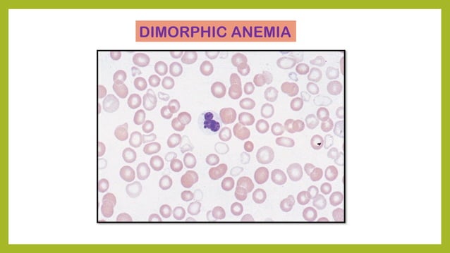 PERFORM, IDENTIFY AND DESCRIBE THE PERIPHERAL BLOOD.pptx