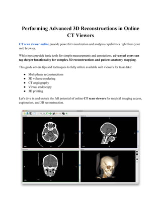 Performing Advanced 3D Reconstructions in Online CT Viewers.pdf