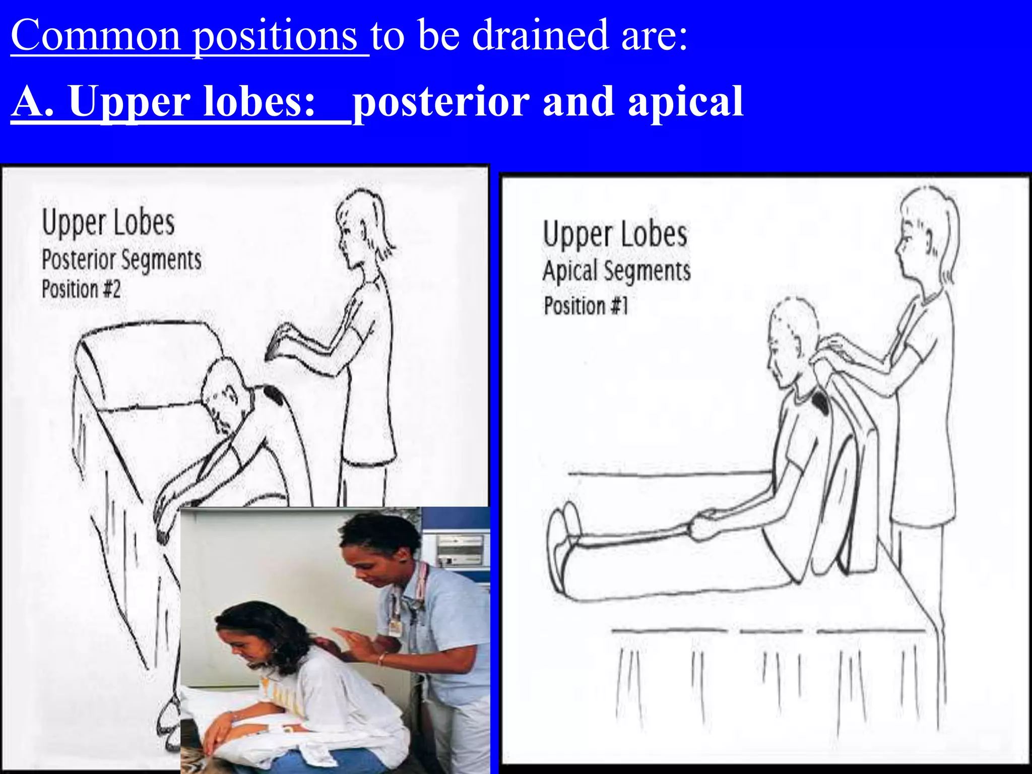 Performing chest physiotherapy | PPT