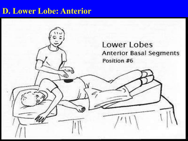 Performing chest physiotherapy | PPT