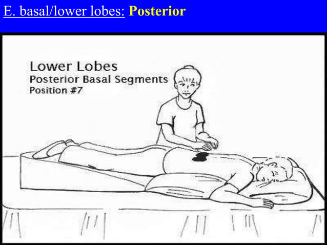Performing chest physiotherapy | PPT