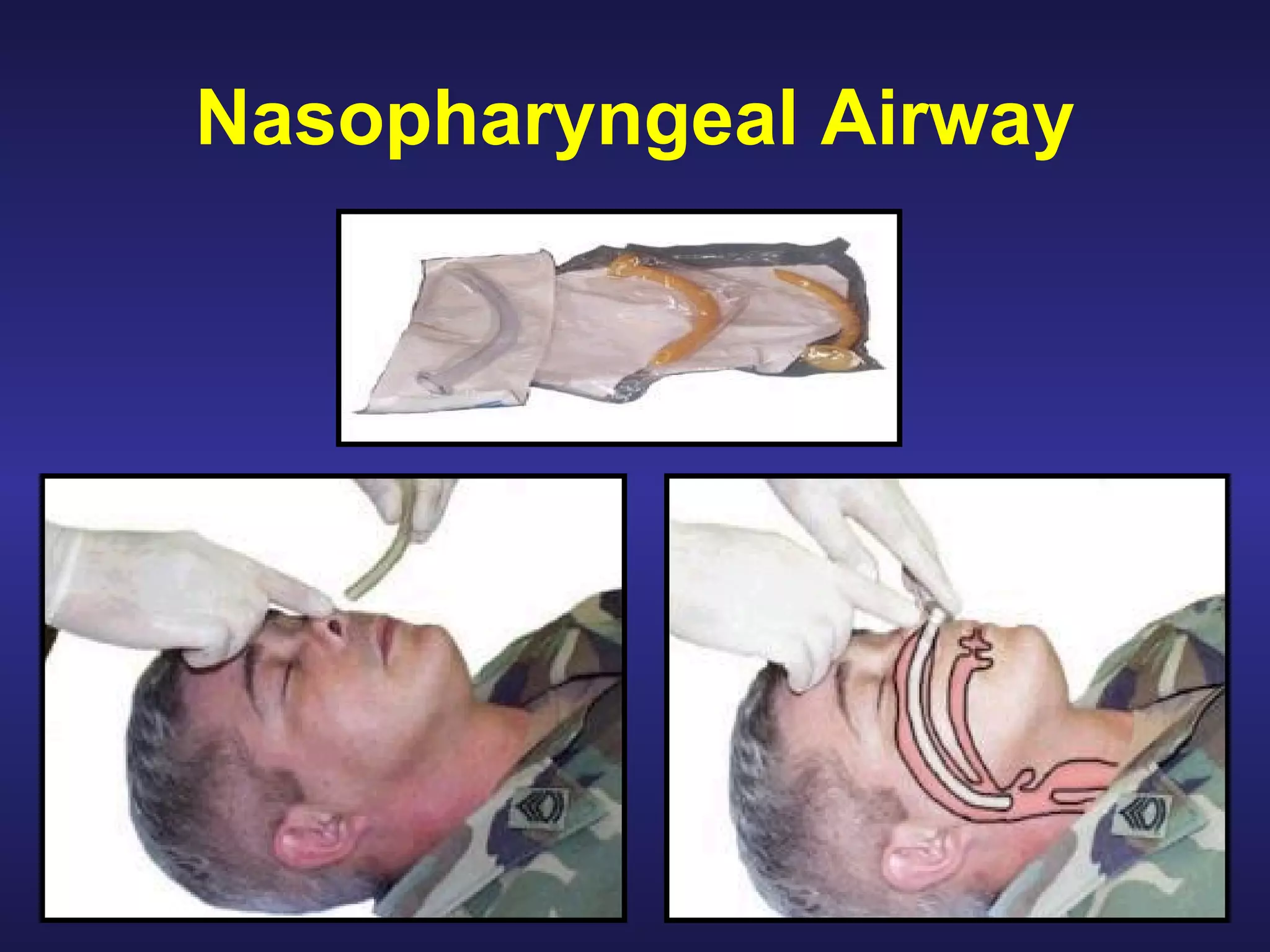 Perform tactical combat casualty care | PPT