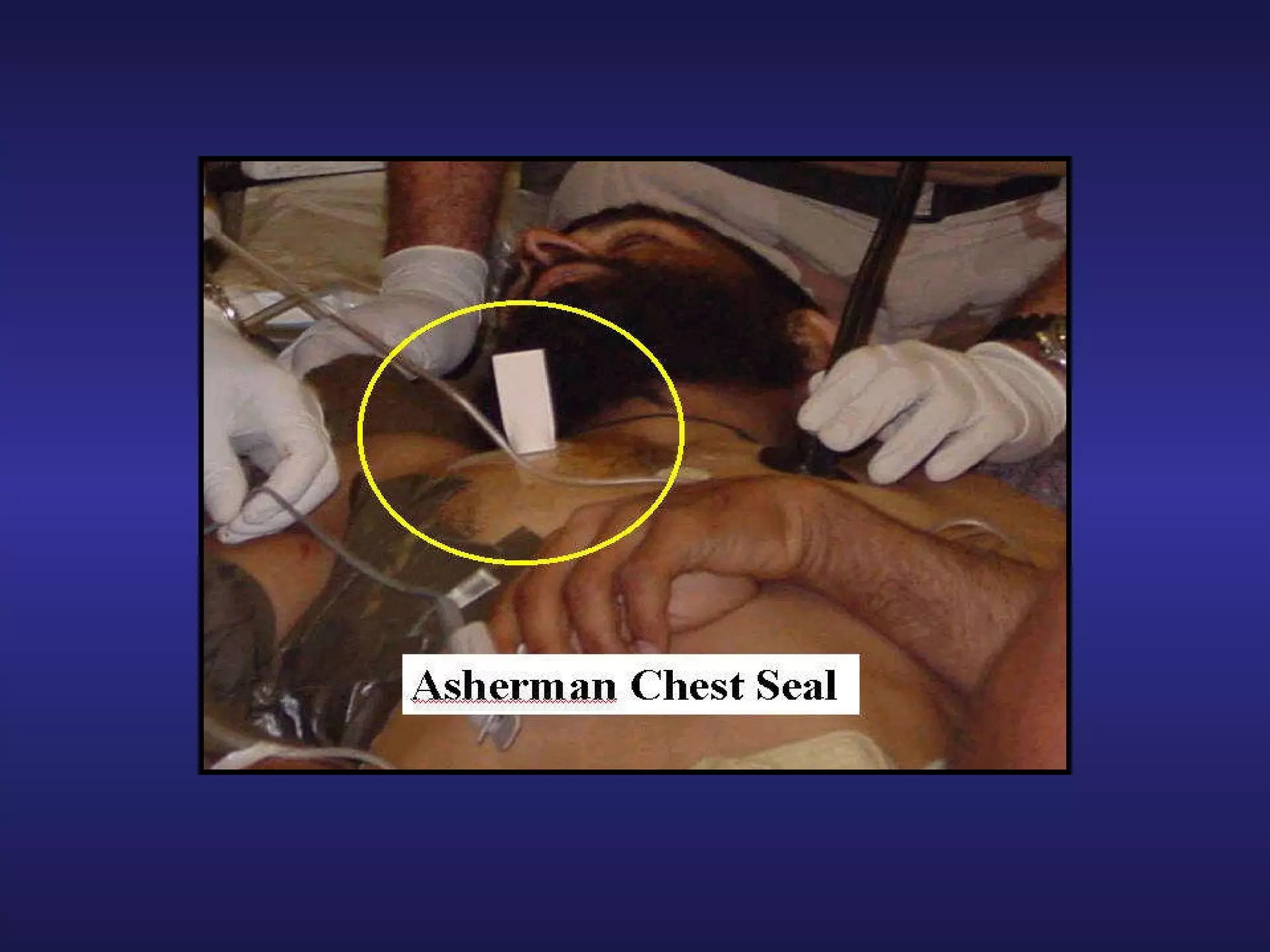 Perform tactical combat casualty care | PPT