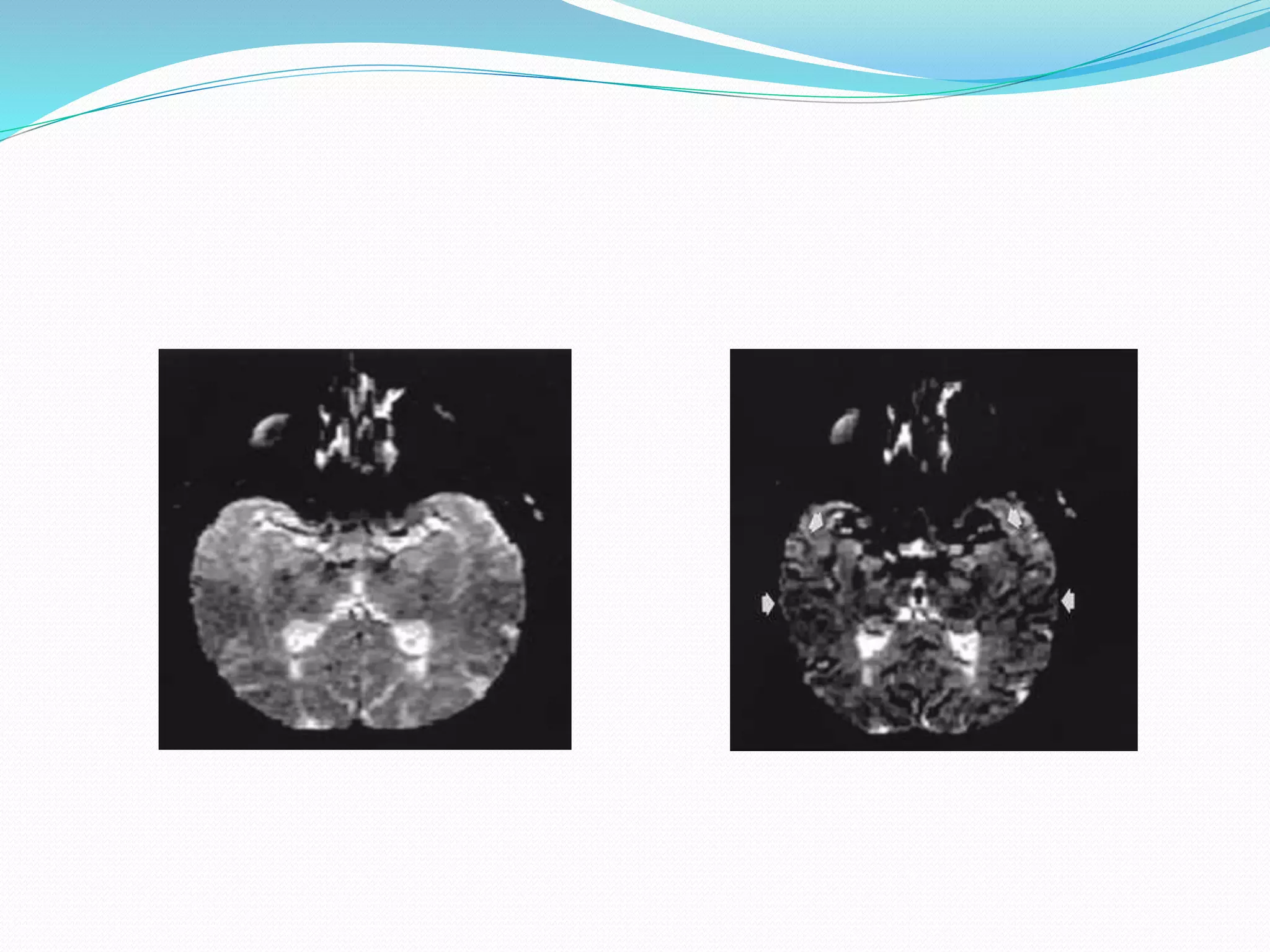 Perfusion and dynamic contrast enhanced mri | PPTX