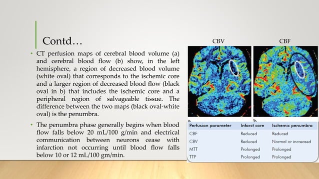Perfusion imaging: CT, MRI, Nuclear Medicine- Avinesh Shrestha | PPTX ...