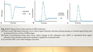 Perfusion imaging: CT, MRI, Nuclear Medicine- Avinesh Shrestha | PPTX