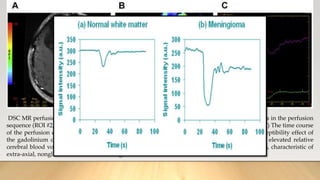 Perfusion imaging: CT, MRI, Nuclear Medicine- Avinesh Shrestha | PPTX