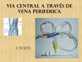 Perfusion intravenosa_venoclisis.ppt