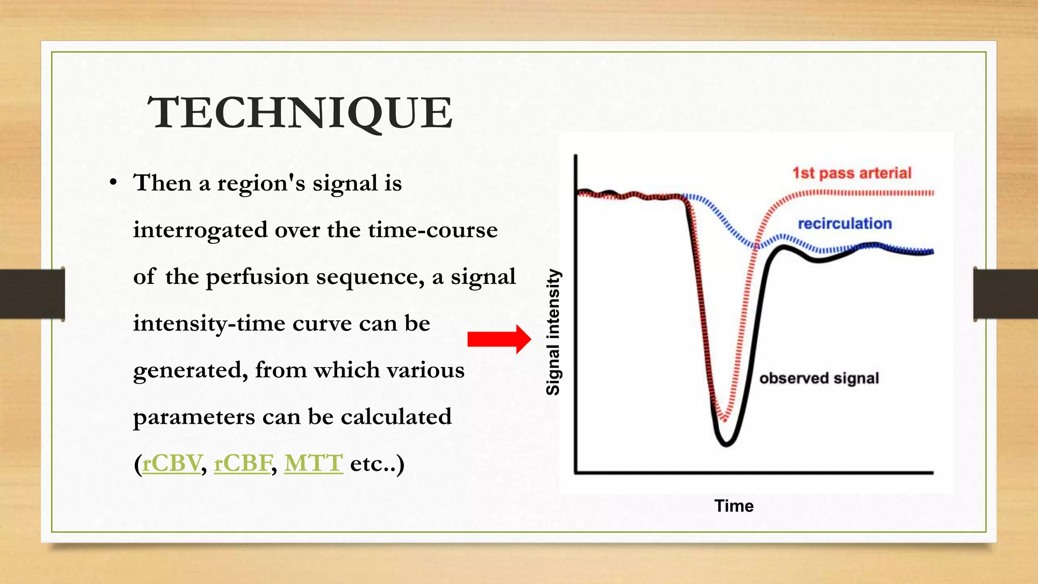 Perfusion MRI (DSC and DCE perfusion techniques) for radiology ...