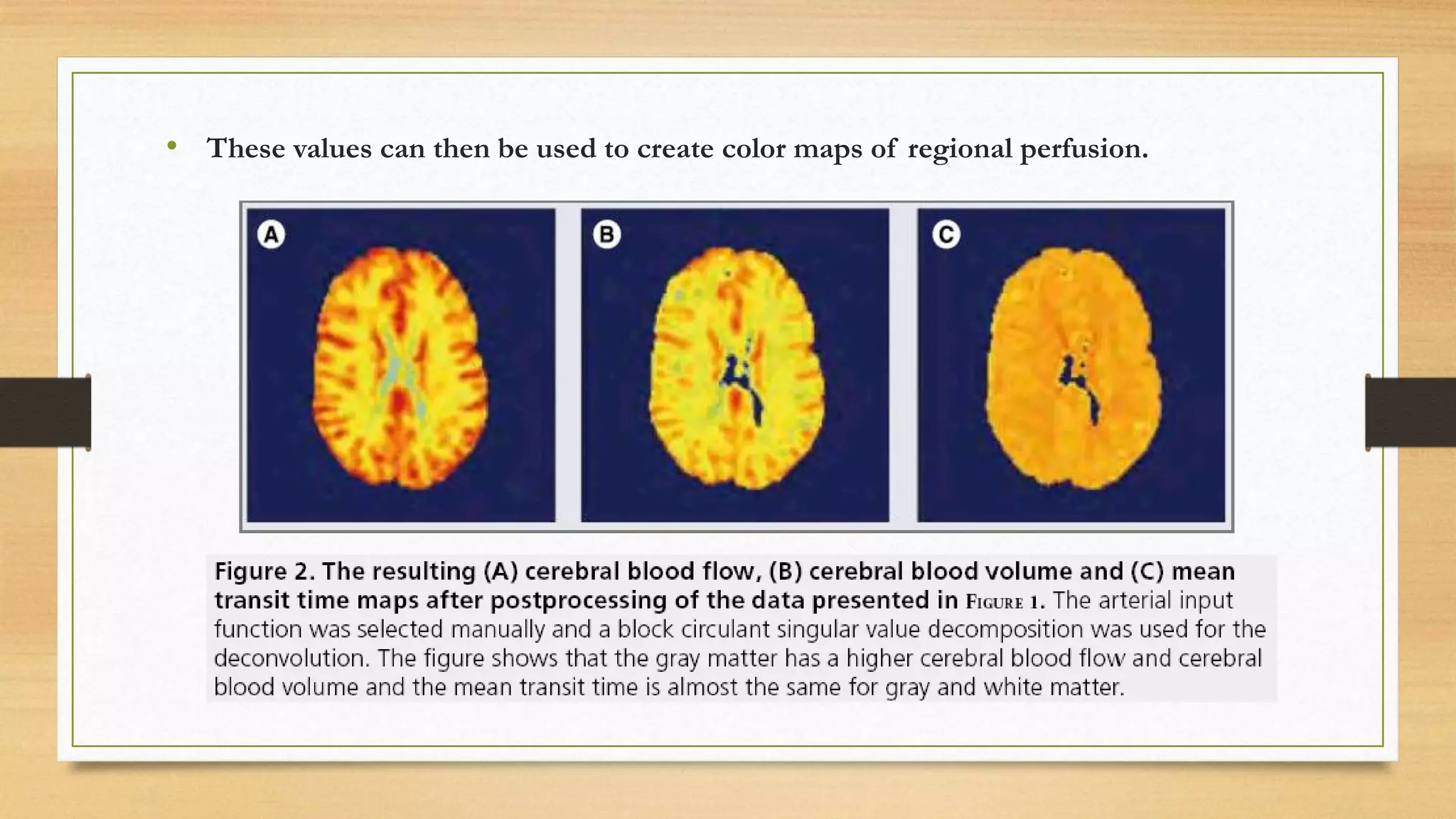 Perfusion MRI (DSC and DCE perfusion techniques) for radiology ...