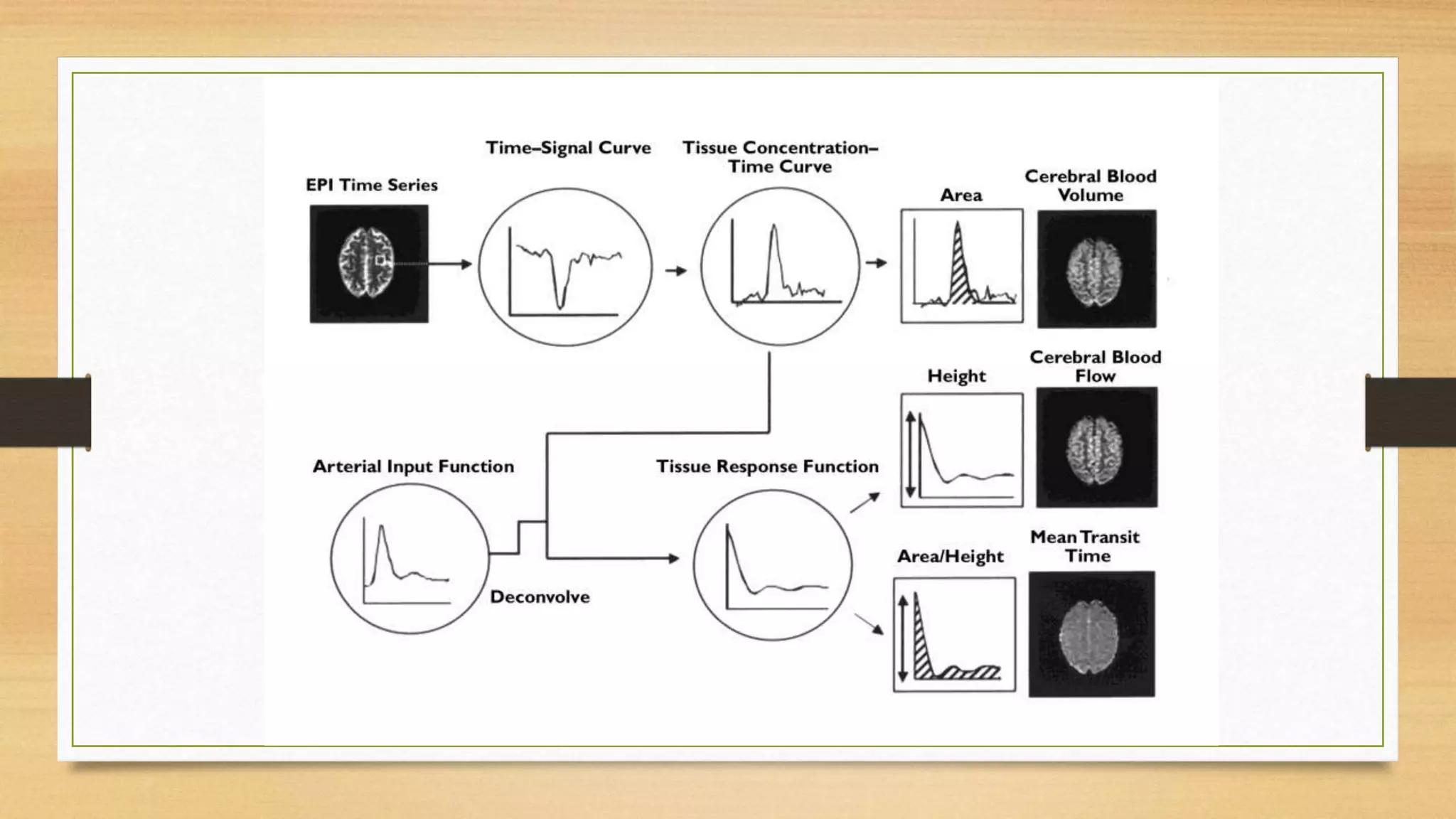 Perfusion MRI (DSC and DCE perfusion techniques) for radiology ...