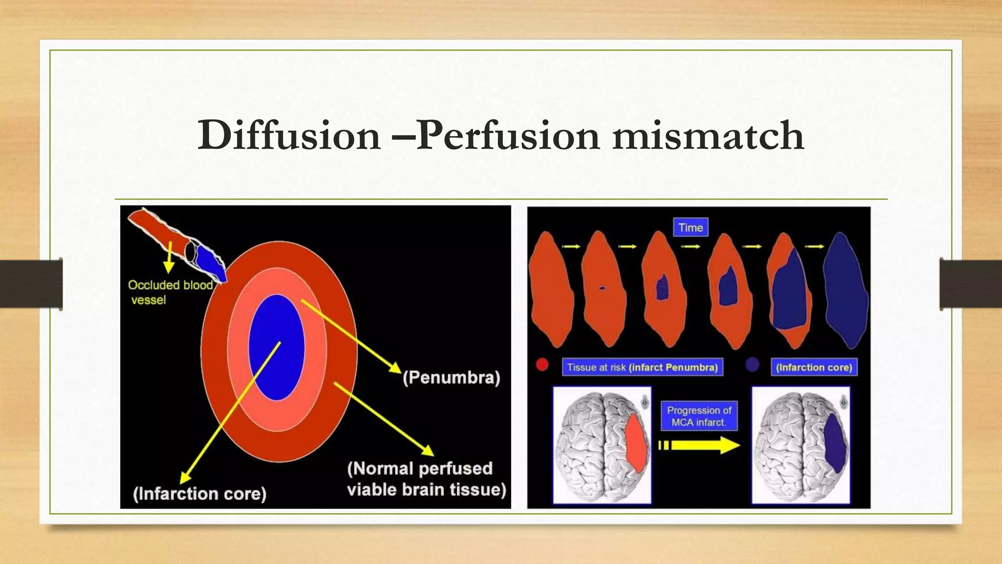 Perfusion MRI (DSC and DCE perfusion techniques) for radiology ...