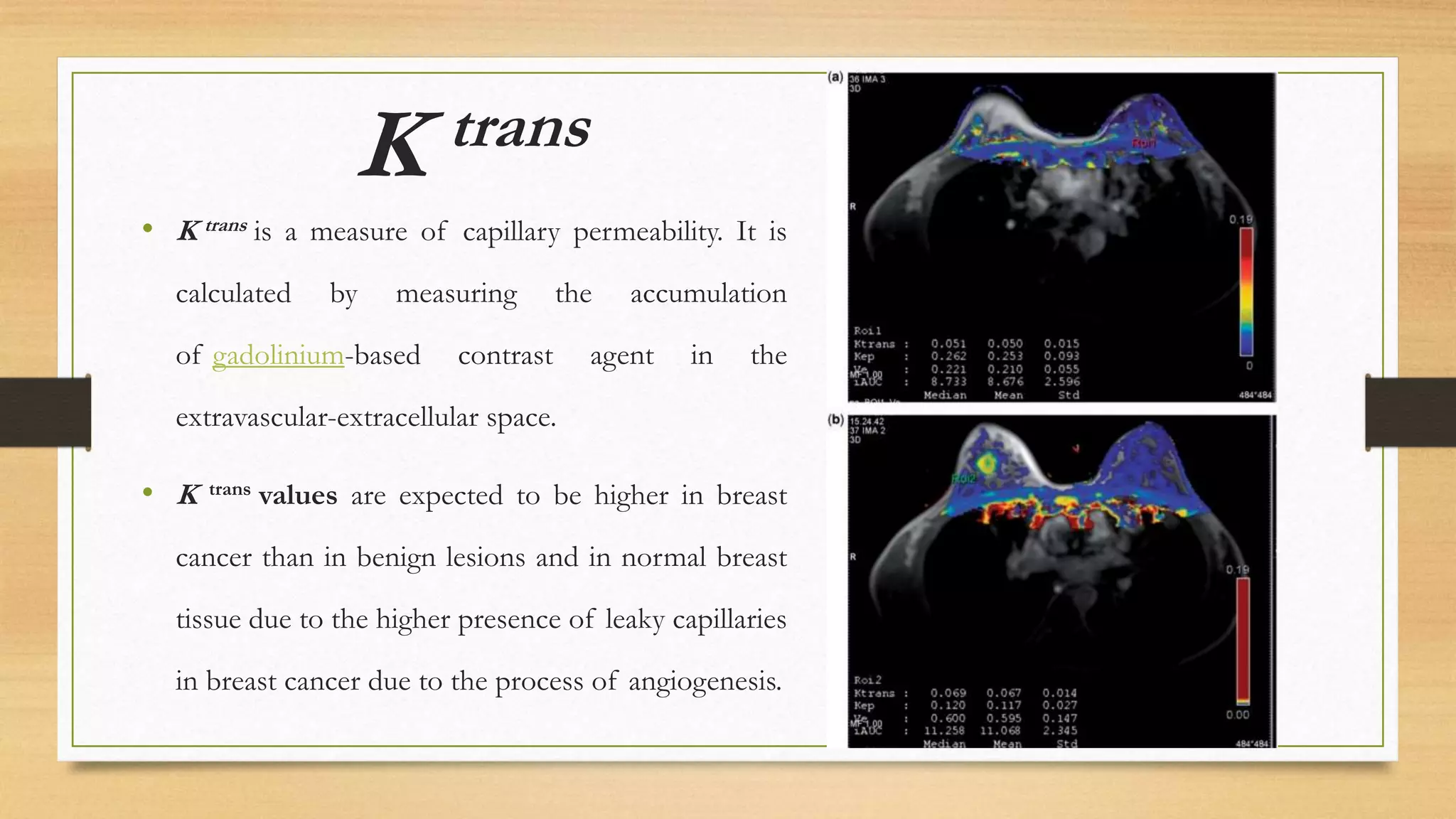 Perfusion MRI (DSC and DCE perfusion techniques) for radiology ...