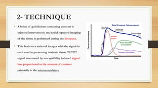 Perfusion MRI (DSC and DCE perfusion techniques) for radiology ...