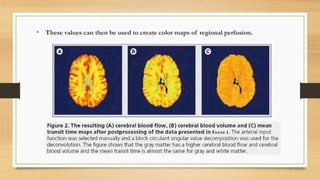 Perfusion MRI (DSC and DCE perfusion techniques) for radiology ...
