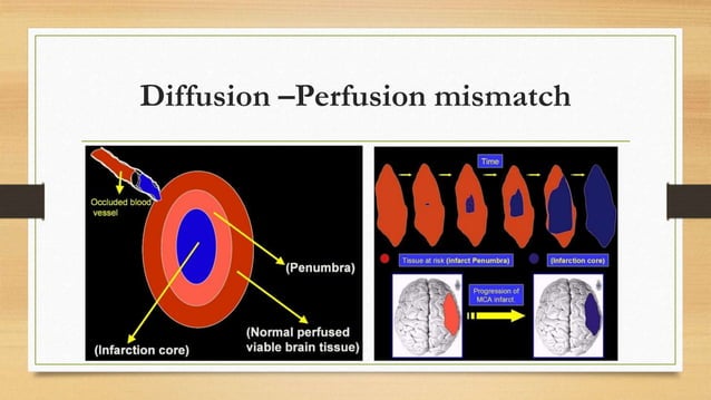 Perfusion MRI (DSC and DCE perfusion techniques) for radiology ...