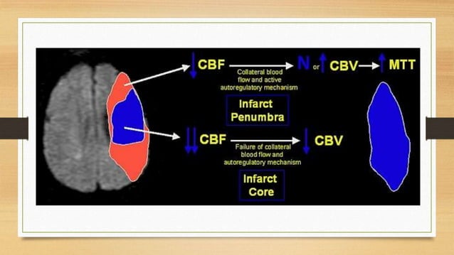 Perfusion MRI (DSC and DCE perfusion techniques) for radiology ...