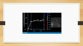 Perfusion MRI (DSC and DCE perfusion techniques) for radiology ...