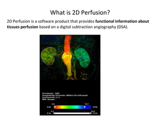 Renal Perfusion after EVAR: functional assessment with 2D perfusion ...