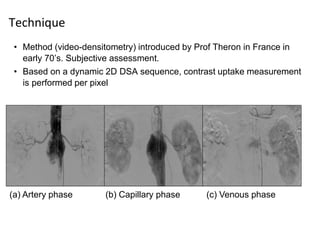 Renal Perfusion after EVAR: functional assessment with 2D perfusion ...