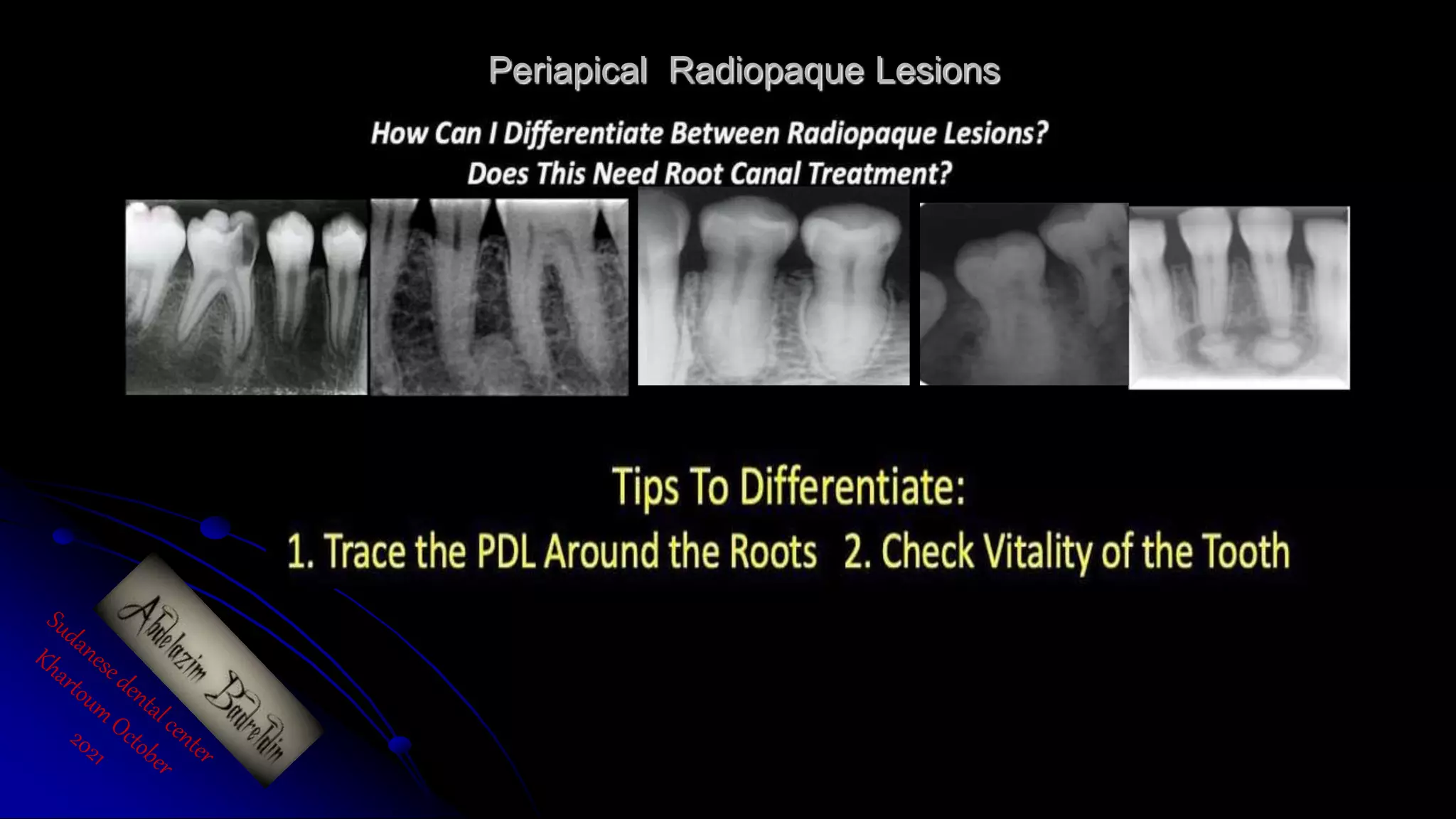 Peri apical radiolucency | PPTX