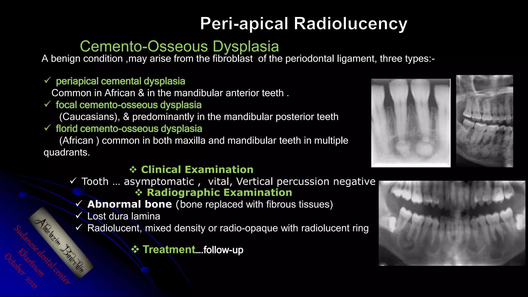 Peri apical radiolucency | PPTX