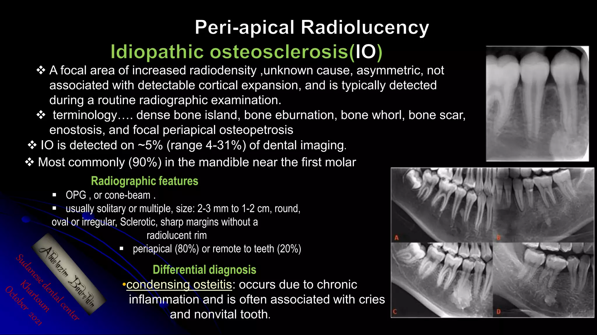 Peri apical radiolucency | PPTX