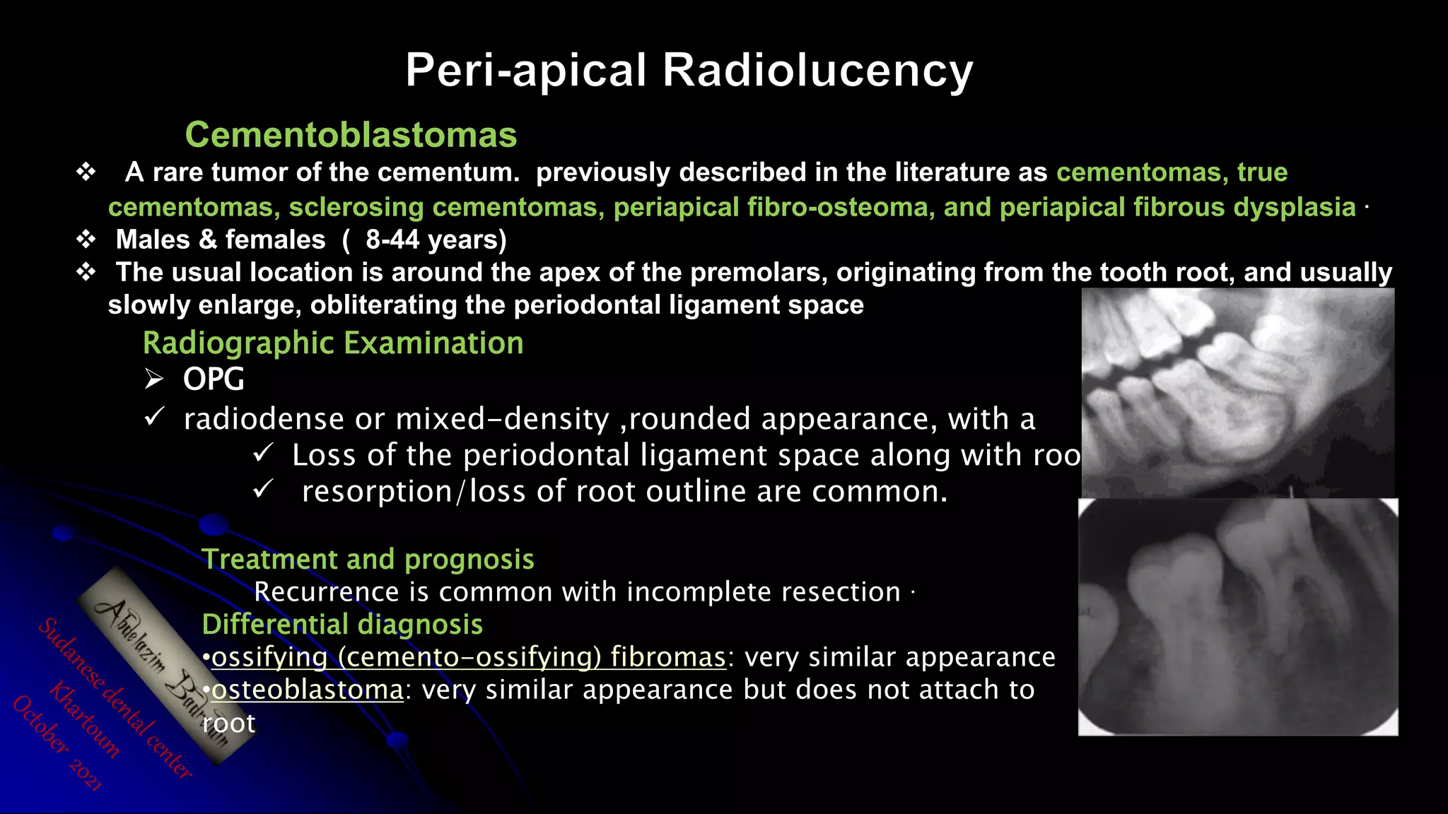 Peri apical radiolucency | PPT
