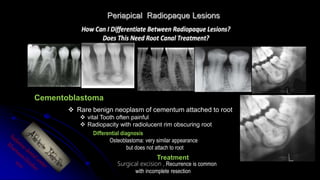 Peri apical radiolucency | PPT