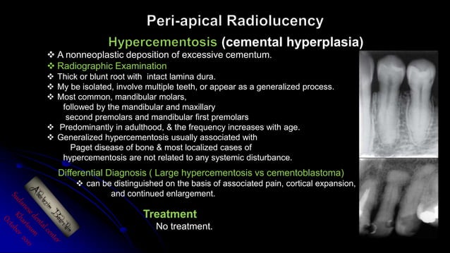 Peri apical radiolucency | PPT
