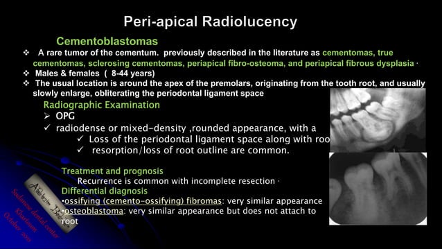 Peri apical radiolucency | PPT