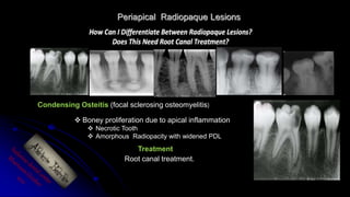 Peri apical radiolucency | PPT