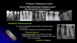 Peri apical radiolucency | PPT