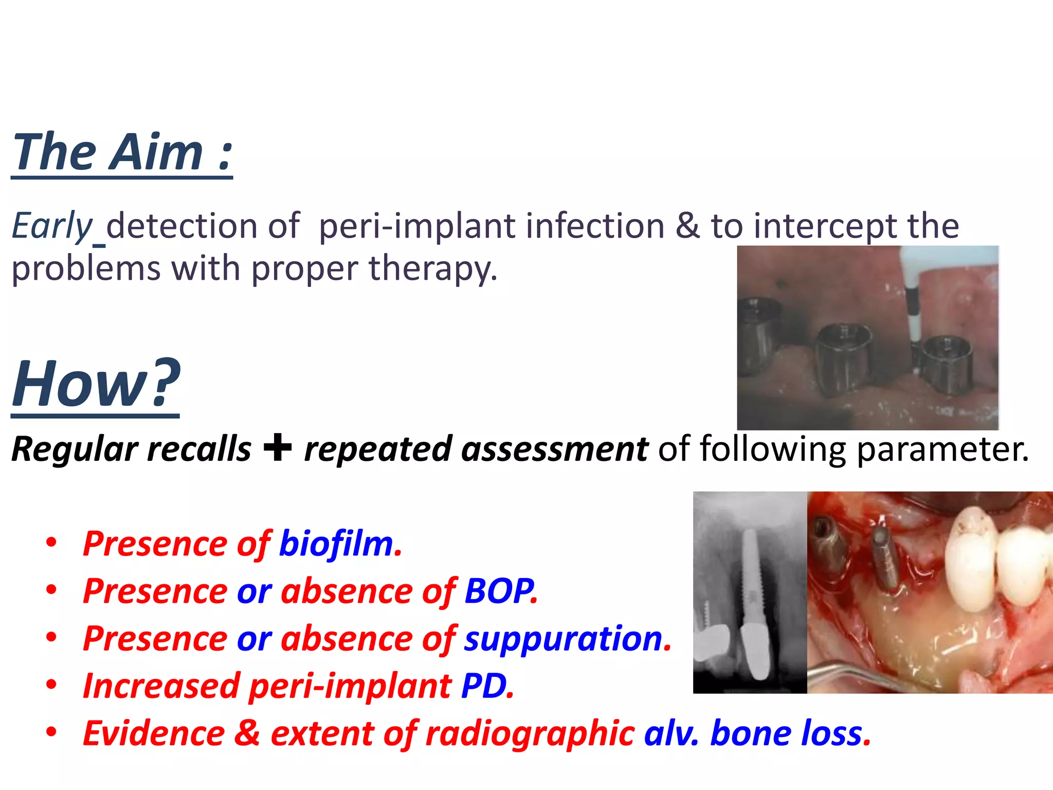 Peri-implant diseases and their treatment. | PPTX