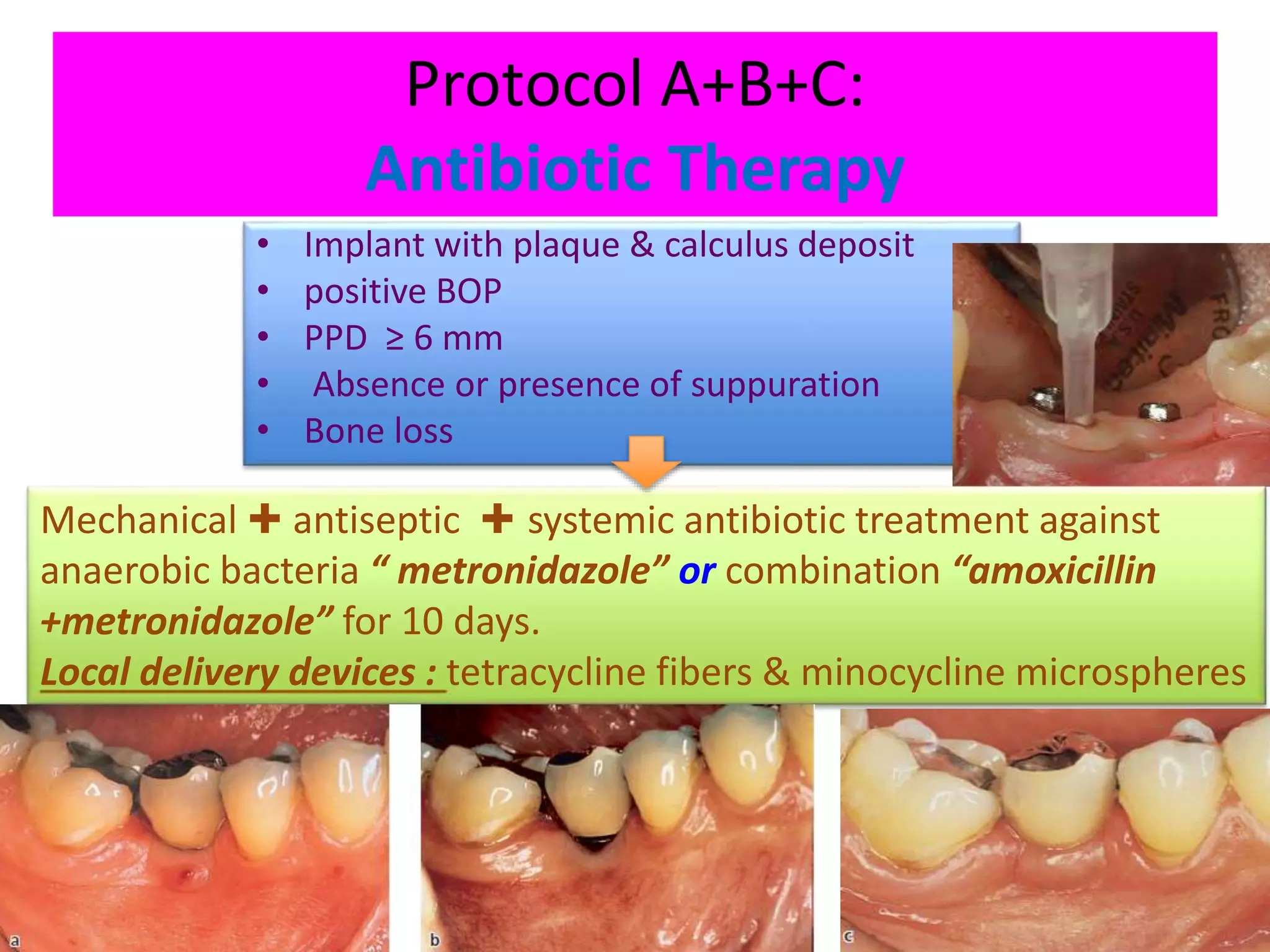Peri-implant diseases and their treatment. | PPTX