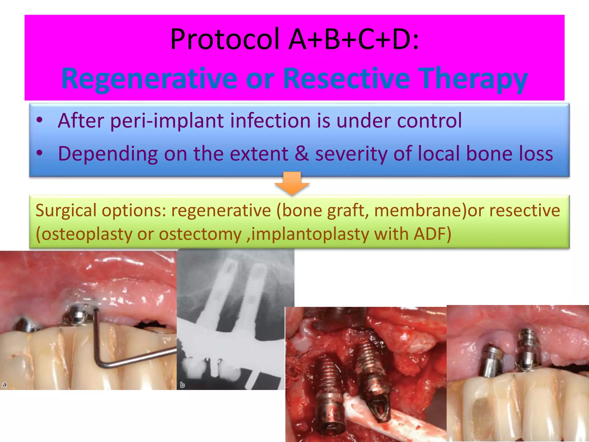 Peri-implant diseases and their treatment. | PPTX