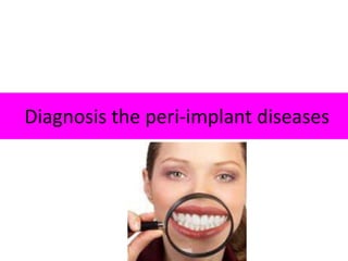 Peri-implant diseases and their treatment. | PPTX