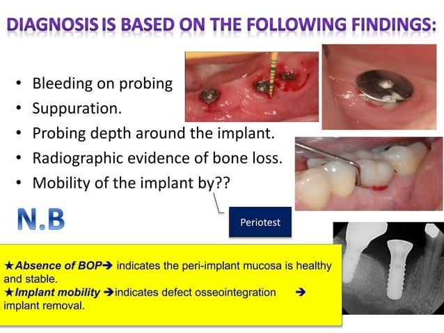 Peri-implant diseases and their treatment. | PPTX
