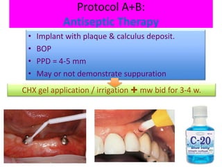 Peri-implant diseases and their treatment. | PPTX
