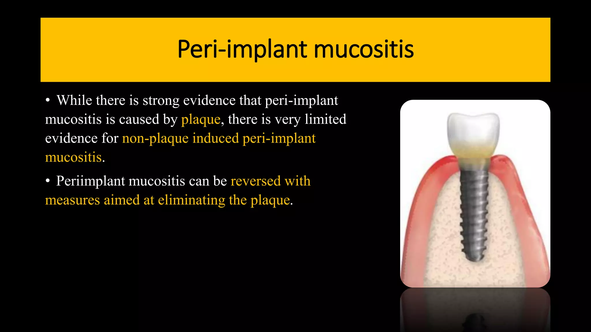 Peri-implant Diseases Classification, Cases Definition and Treatment.pdf