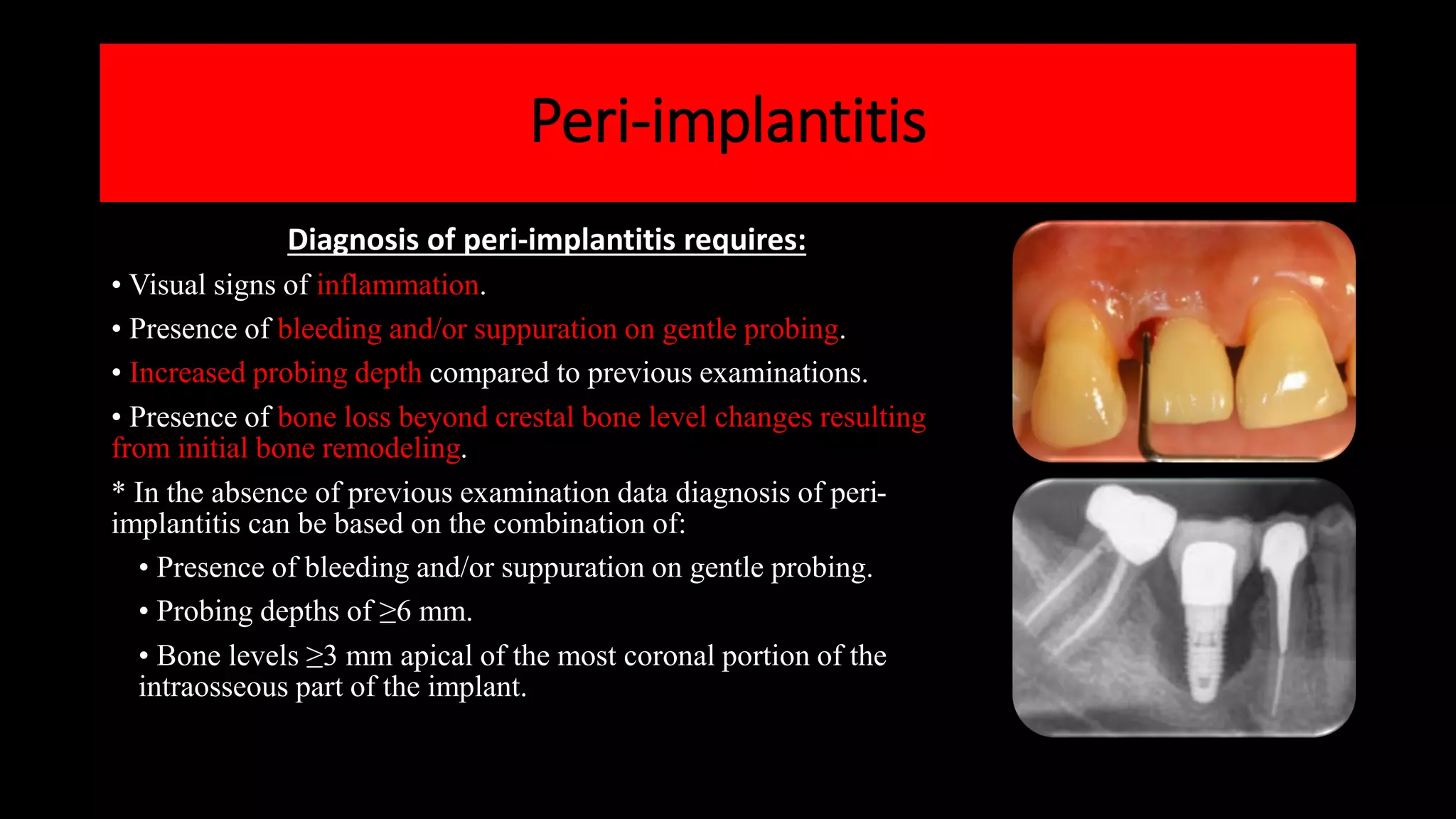 Peri-implant Diseases Classification, Cases Definition and Treatment.pdf