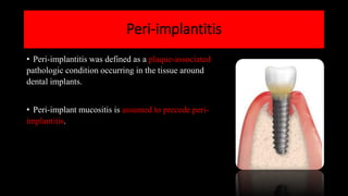 Peri-implant Diseases Classification, Cases Definition and Treatment.pdf