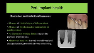 Peri-implant Diseases Classification, Cases Definition and Treatment.pdf