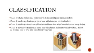 Peri implantitis | PPTX