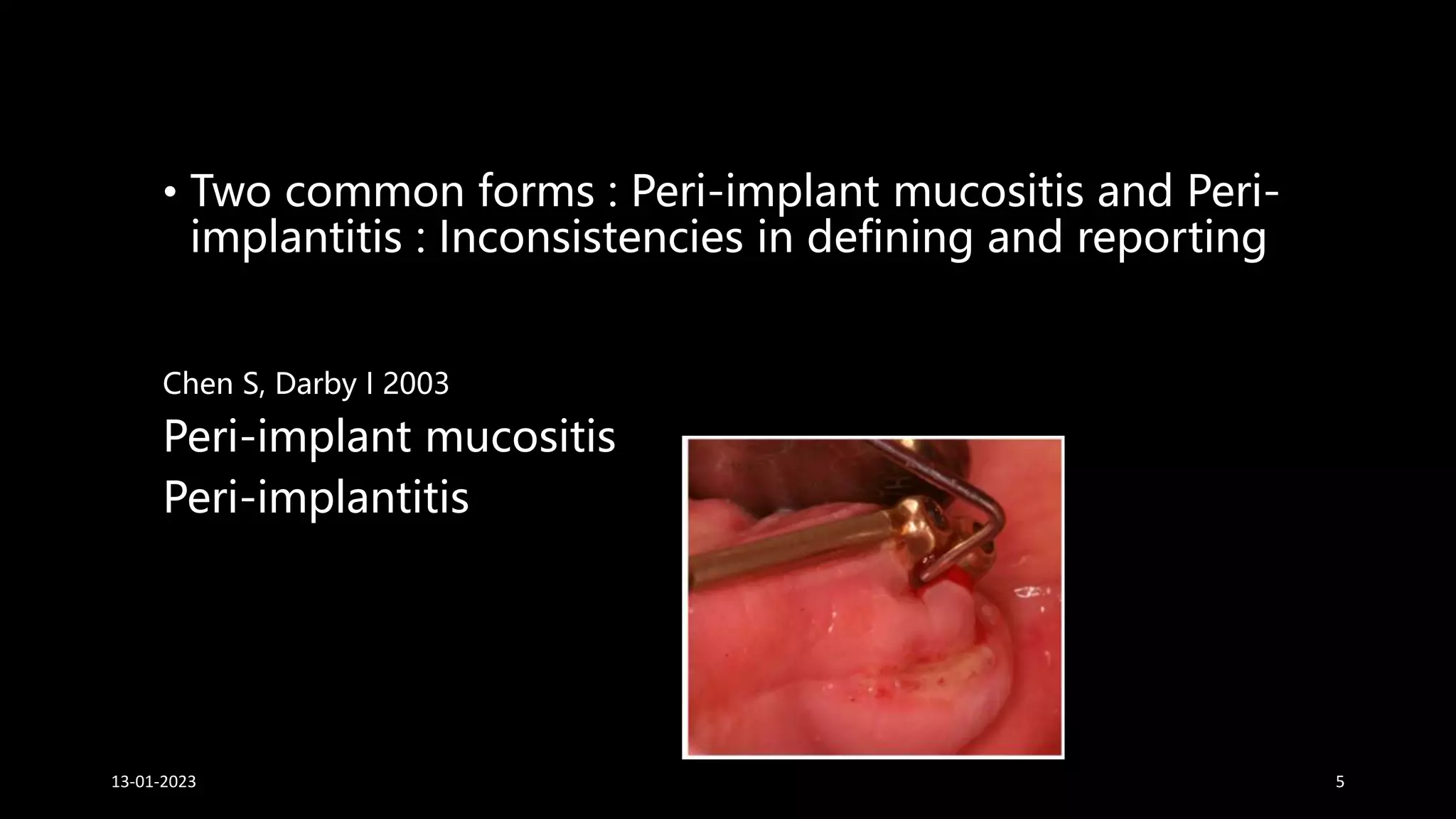 PERI-IMPLANTITIS.pptx