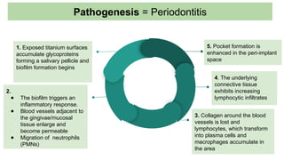 Peri-implantitis periodontal health pathogenesis | PPTX