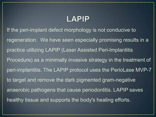 Peri implantitis treatment protocol | PDF