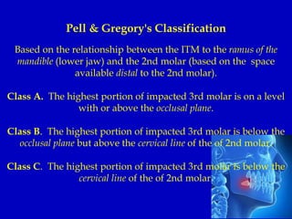 Impacted third molar management | PPTX