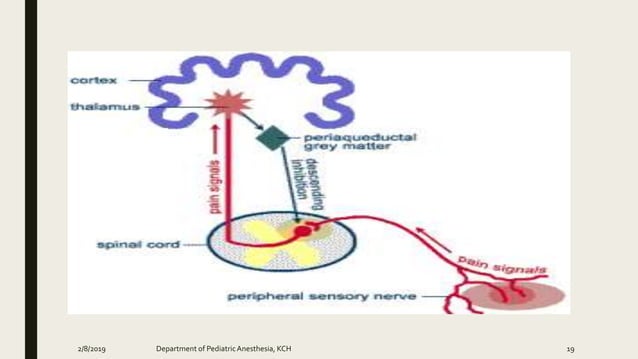 Peri operative pain management | PPTX | Brain and Nervous System ...